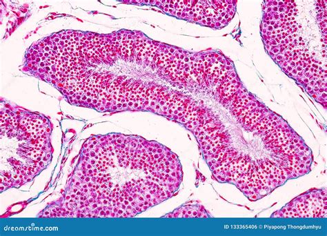 Cross Section Of Testis Diagram