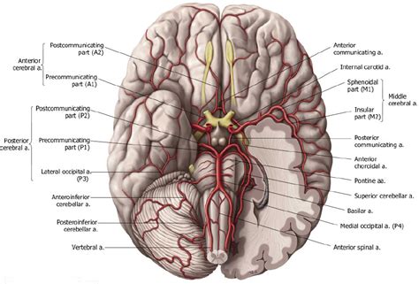 5 Vascular Abnormalities Radiology Key