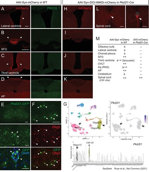 Cerebrospinal Fluid Contacting Neuron Tracing Reveals Structural And
