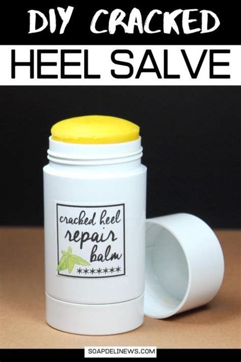 Cracked Heel Salve Recipe With Essential Oils For Natural Skin Care