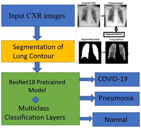 Ijerph Free Full Text An Efficient Deep Learning Model To Detect