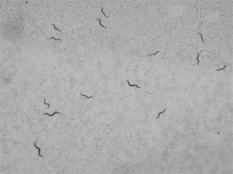 insights on sex and death from a mutant roundworm bioinformatics