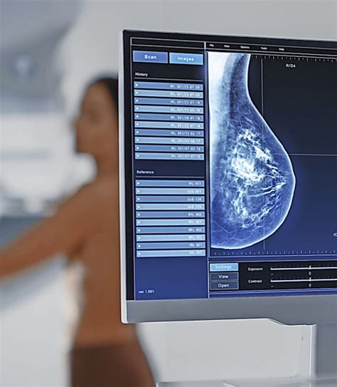 New Method For Early Breast Cancer Detection Developed At Paul Scherrer