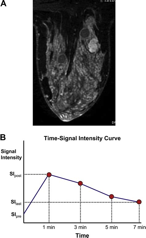 Dynamic Contrast Enhanced Breast Mr Imaging Magnetic Resonance