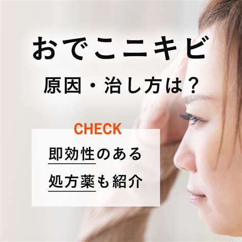 おでこニキビの原因と治し方を解説！即効性のある処方薬も紹介｜ans Magazine