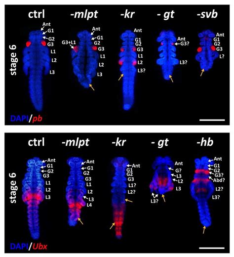 Hox Gene Expression In Knockdown Embryos Of Mlpt And Other
