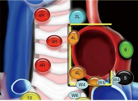 Insight Into The Differences In Classification Of Mediastinal And Hilar