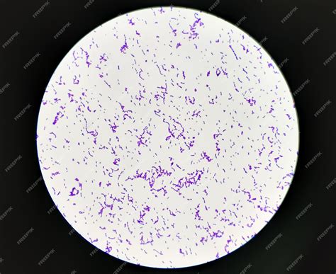 Staphylococcus Aureus Morphology Visualised Using Gram
