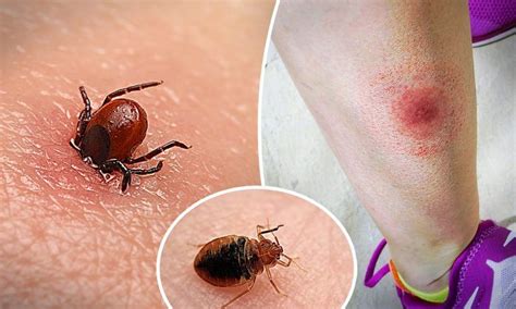 10 Common Insect Bites What To Expect And How Recognize And Treat Them