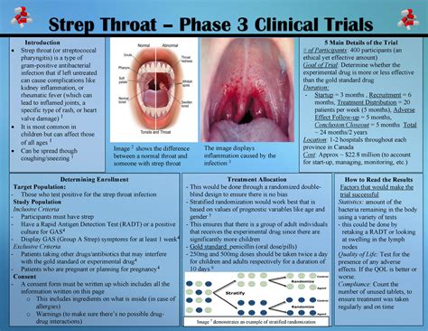 Strep Throat Poster Introduction Strep Throat Or Streptococcal