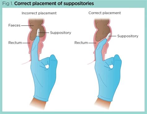Discover What A Rectal Massage Can Do For You