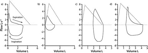 how to calculate predictive flow volume curve in