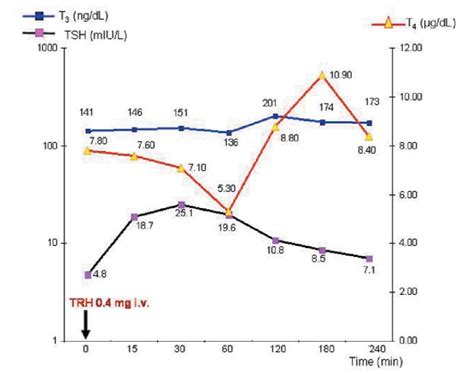 Serum Tsh And Thyroid Hormones Values During Trh Test Download