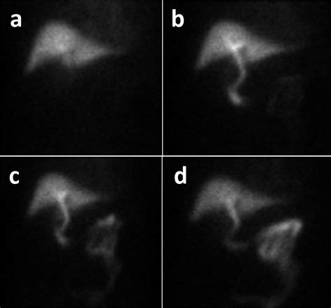hida ct scan ct scan machine