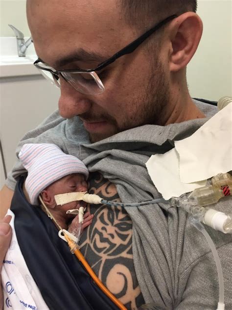 Pai Relembra Momentos De Aflição Após Filha Que Nasceu Prematura Passar