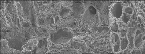 Scanning Electron Microscopy Sem Of Decellularized Pancreata Sem At