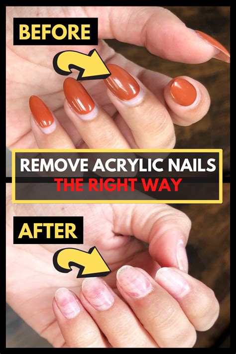 How To Remove Acrylic Nails The Right Way At Home – Artofit