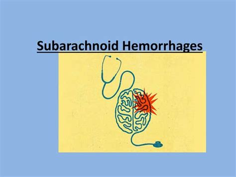 Subarachnoid Hemorrhage Ppt