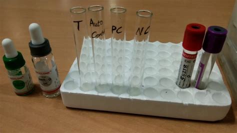 Indirect Coombs Test By Tube Method Youtube