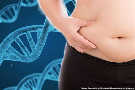 Genes Y Desequilibrio Energético Causan Obesidad Gaceta Unam