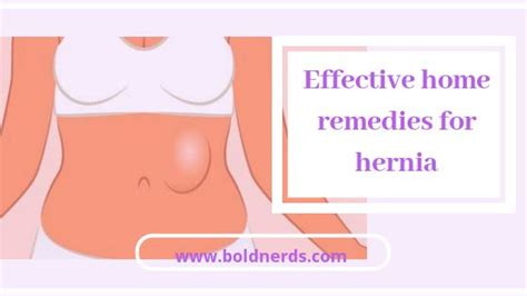 10 Effective Natural Home Remedies For Hernia Bold Nerds Natural