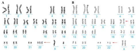 Chromosome 22