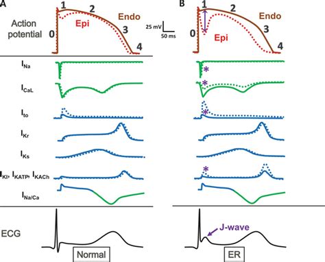 A Clinical Approach To Early Repolarization Circulation