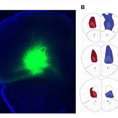 A Representative Example Of Viral Expression In The Orbitofrontal