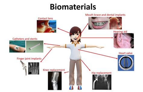 What Are Biomaterials