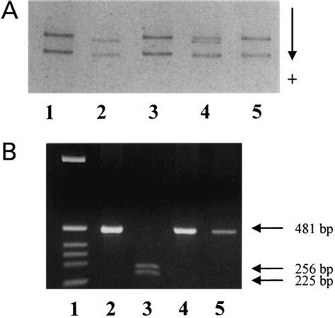 Sscp Patterns And Restriction Enzyme Analysis Of The Pcr Fragments