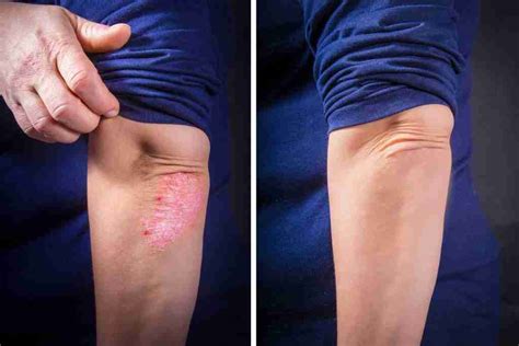 10 Amazing Benefits Of Banana Peels You Should Know Viral Piece
