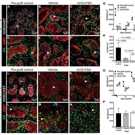Immunoexpression Of Ar And Amh In Prepubertal Human Testis Xenografts
