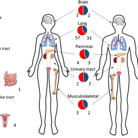 Tmb And Microsatellite Status According To The Organ Of Origin Points