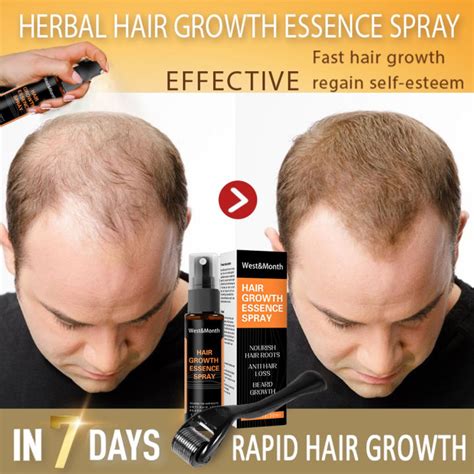 Putimi Hair Grower For Men Original Spray Minoxidil Hairtech Original