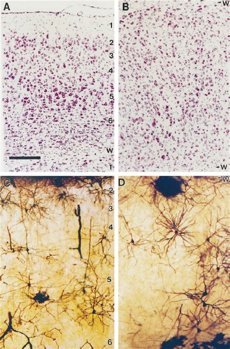 Histological Appearance Of The Normotopic Neocortex And Heterotopic
