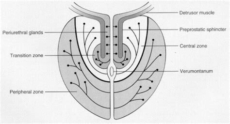 Radiologic Anatomy Of The Prostate Gland A Clinical Approach