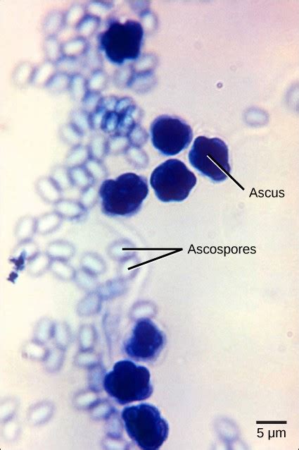 Classifications Of Fungi Openstax Biology