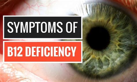9 Signs Of Vitamin B12 Deficiency