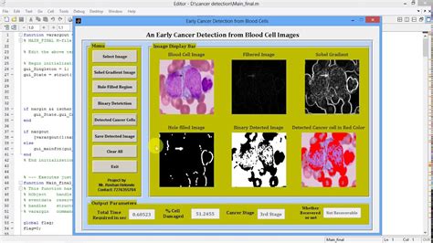 brain tumor detection using image processing python code brain tumor