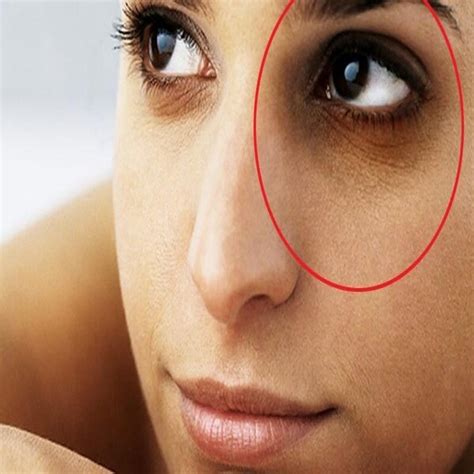 Best And Easy Skin Care Tips For Girls In 2020