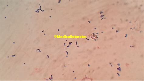 Streptococcus Pyogenes Introduction Morphology Pathogenicity