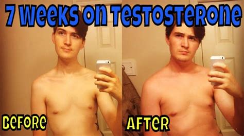 7 Weeks On Testosterone Replacement Therapy Youtube