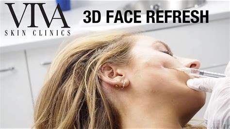 3d Face Refresh Viva Skin Clinics Dermal Fillers Youtube