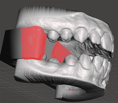 solved using sculpt tools in meshmixer autodesk community