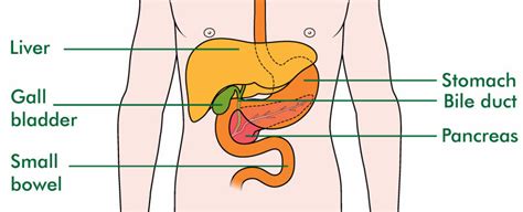 Bile Duct Cancer
