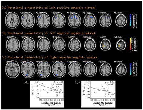 Maps Of Functional Connectivity Of Amygdala A Decreased Functional