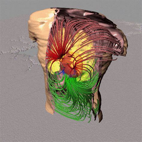 vector field visualization using streamlines