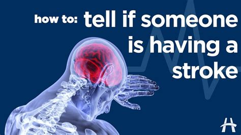 How To Tell If Someone Is Having A Stroke Youtube