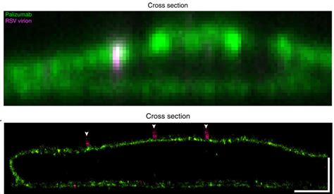 Virology Applications With Single Molecule Localization Microscopy Bruker