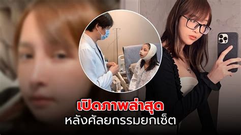 ว้าว เปิดภาพล่าสุด กวาง เดียร์ลอง หลังศัลยกรรมยกเซ็ต ให้เหมือน เจนนี่